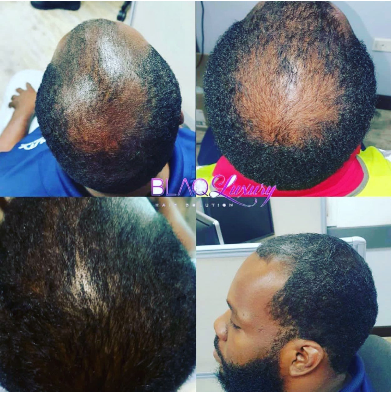 Sage & Lychee Bundle | Shampoo, Conditioner, Hair Masque, Styling ...